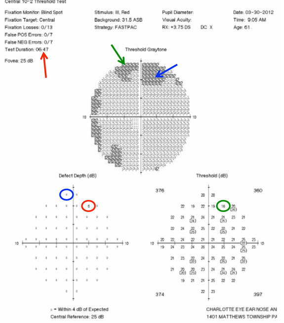 10 2 Visual Field III Red Stimulus Interpreting The Normal Field